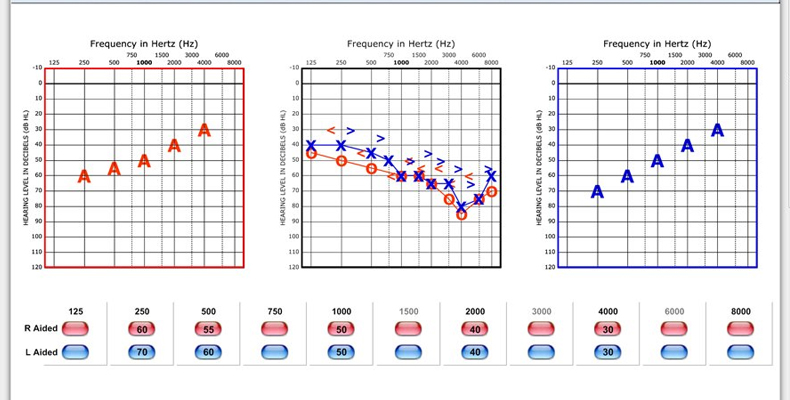 VELLORE SPEECH & HEARING CENTRE
